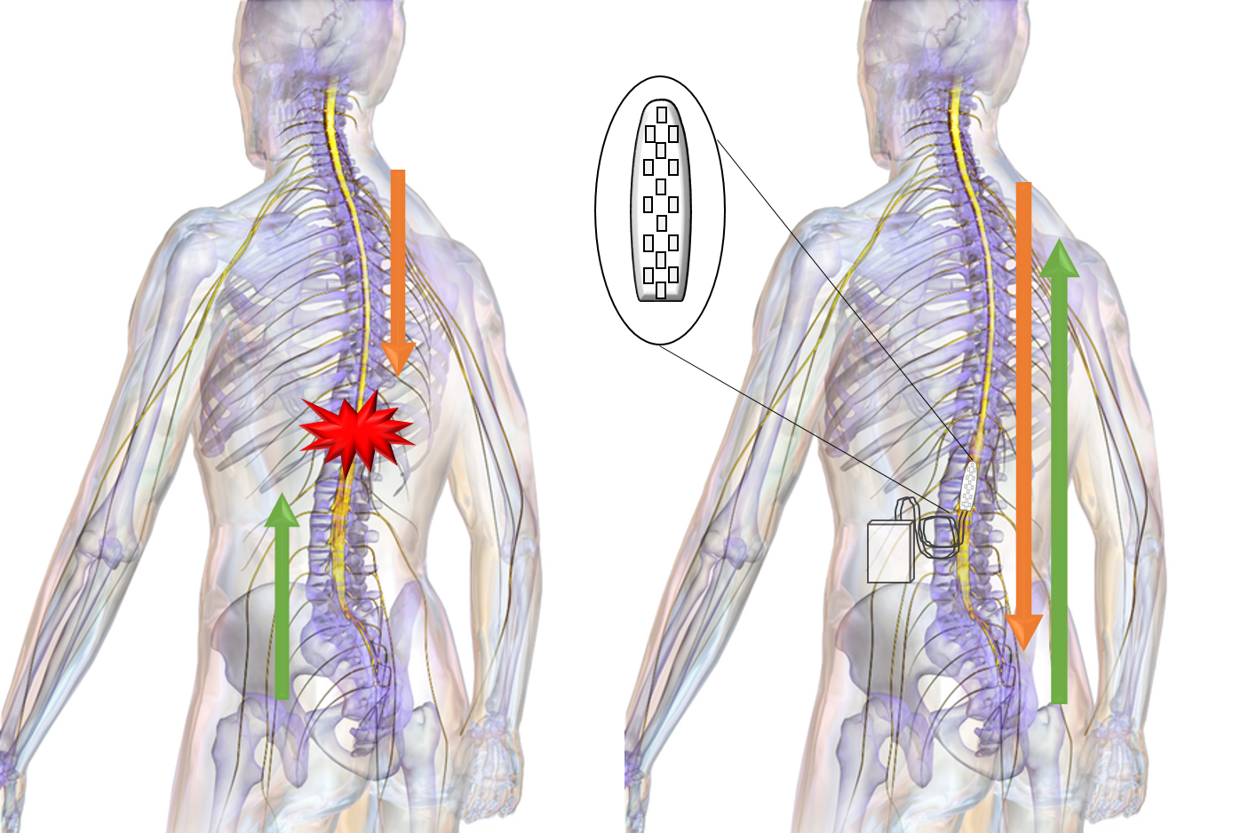 Shocked into Strolling – PennNeuroKnow