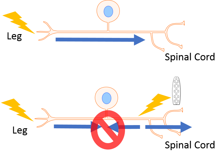 Shocked into Strolling – PennNeuroKnow