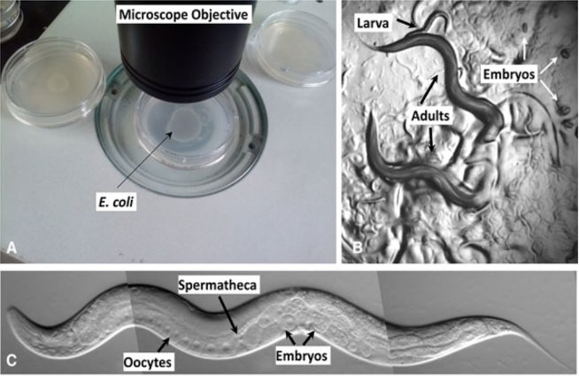 The neuroscience of worms – PennNeuroKnow