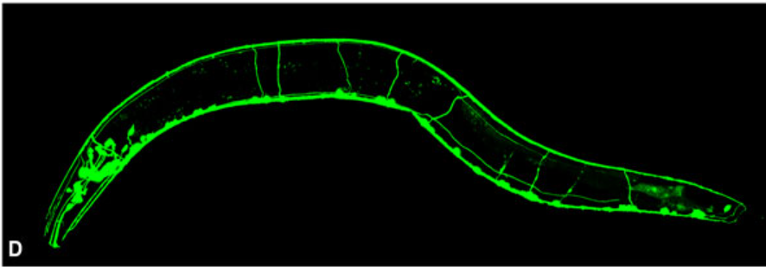 The neuroscience of worms – PennNeuroKnow