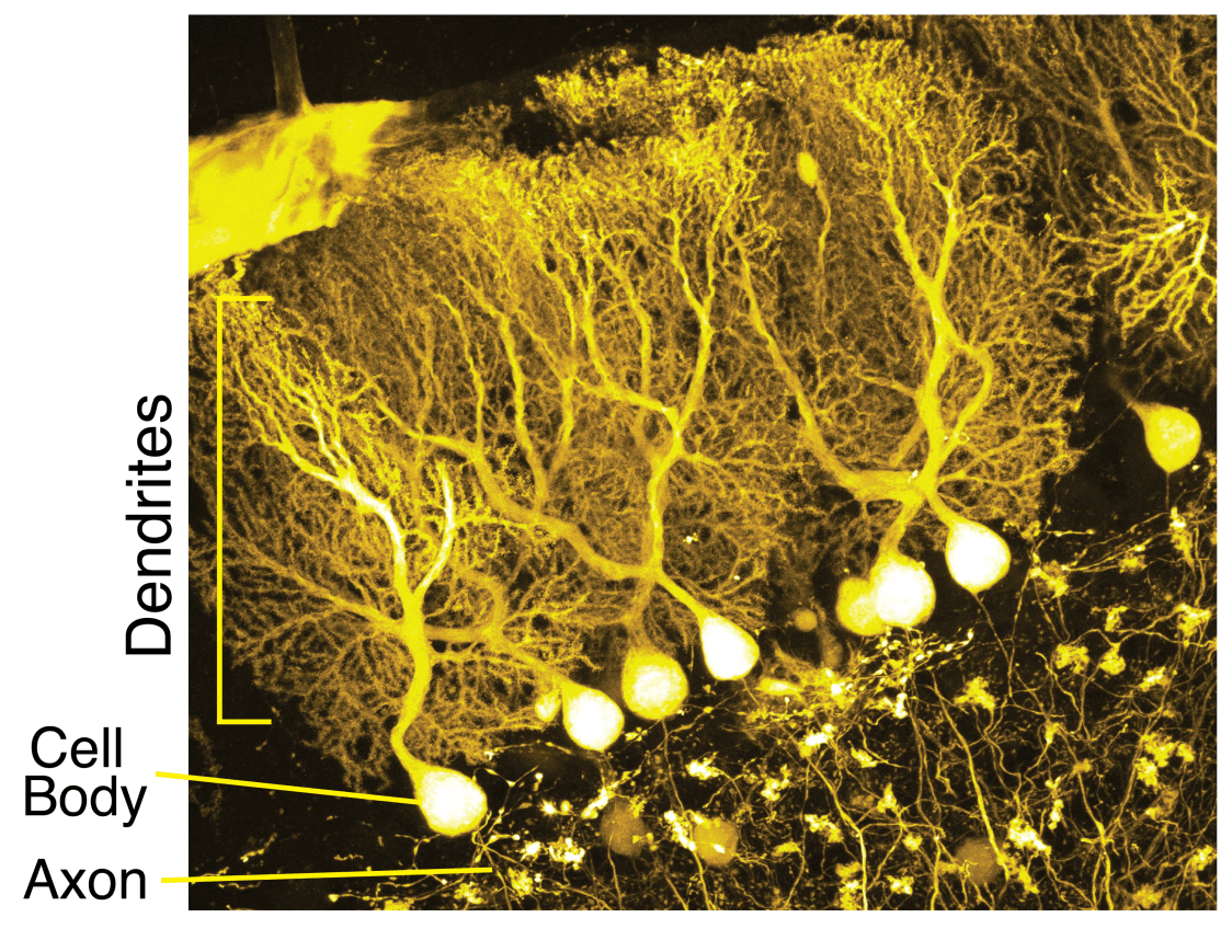 Seeing the forest for the trees – PennNeuroKnow