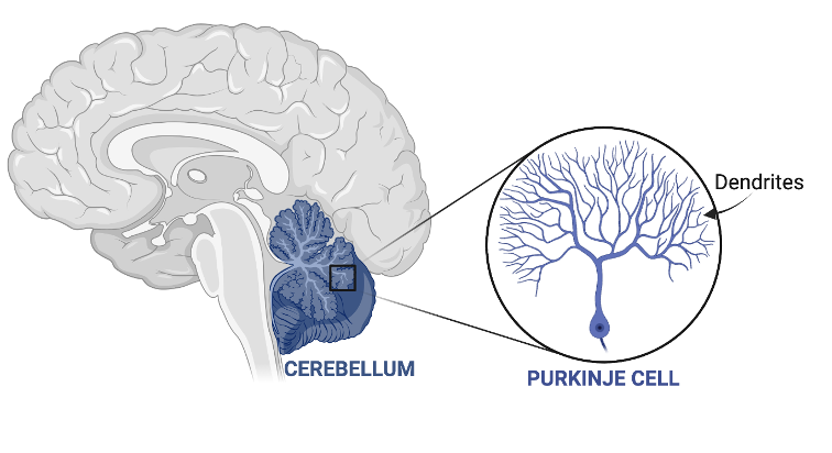 Autism spectrum disorder linked to long-ignored brain area – PennNeuroKnow