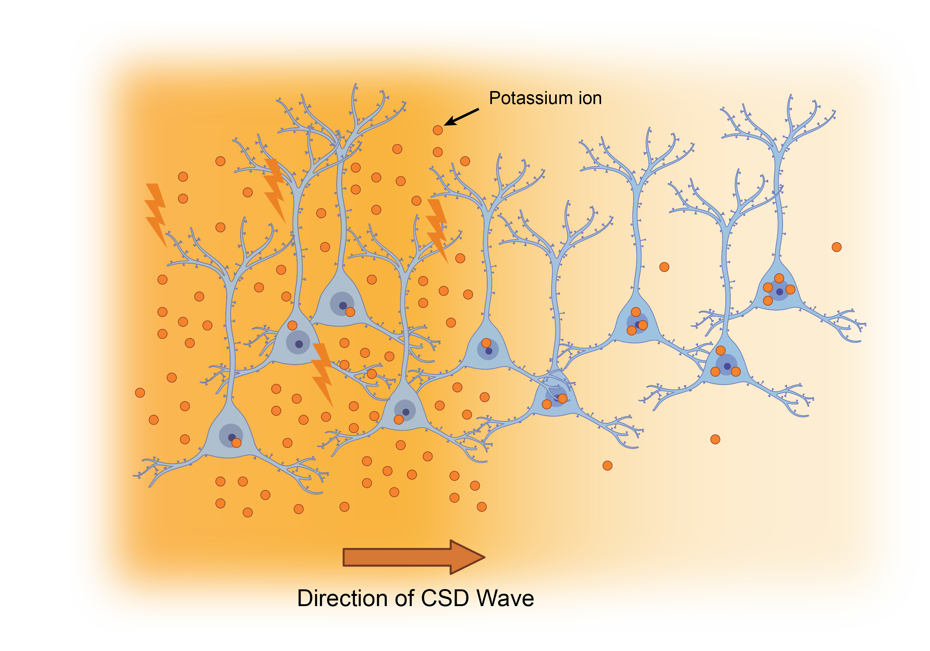 Catching the brain’s tallest waves – PennNeuroKnow