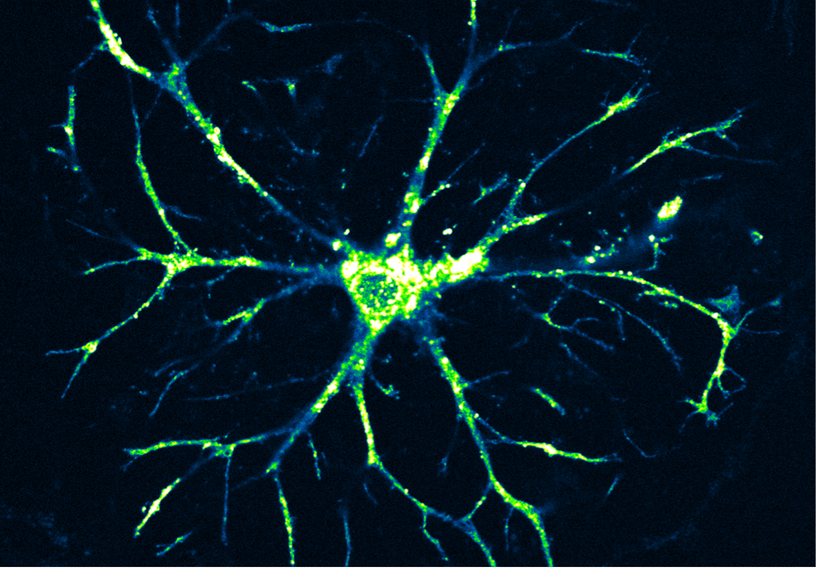 Astrocytes: the “stars” of our central nervous system – PennNeuroKnow
