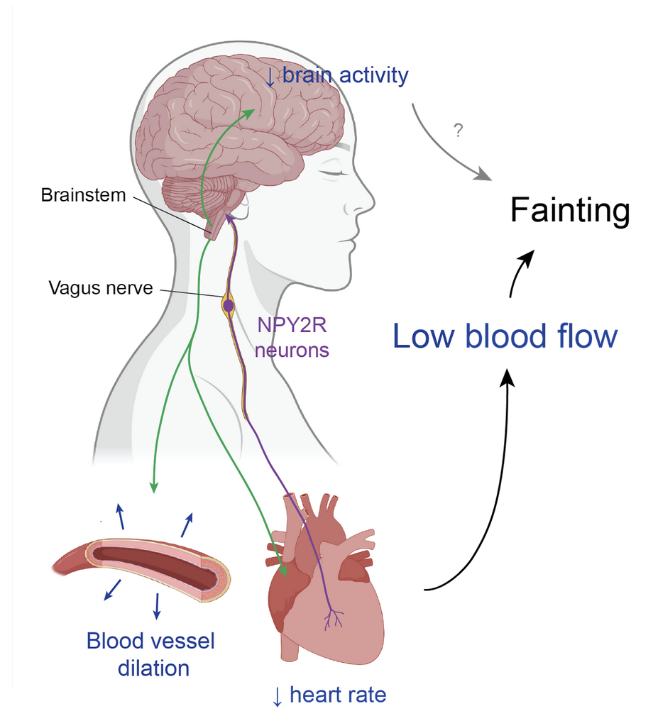 Not for the faint of heart – PennNeuroKnow