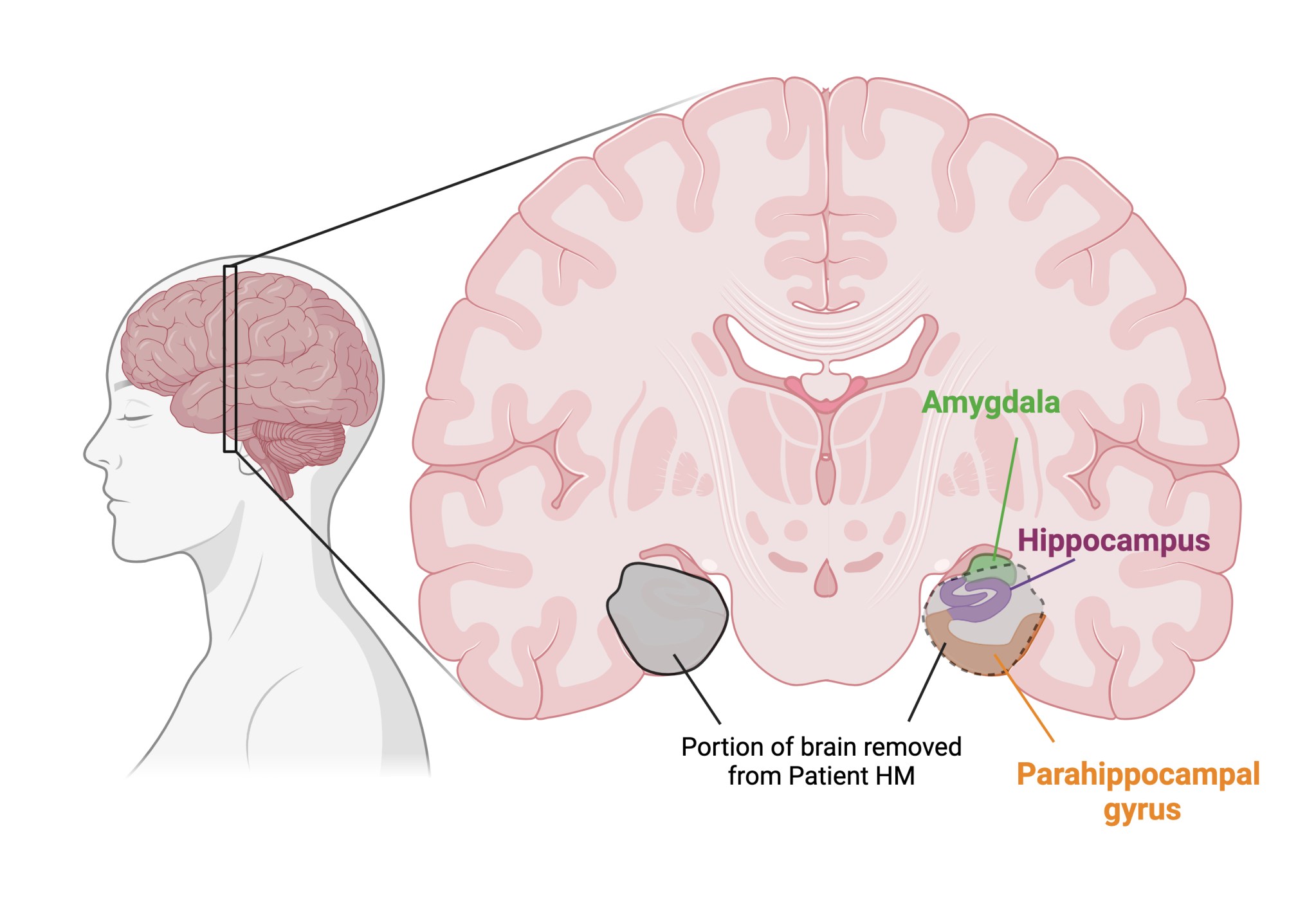 Patient H.M.: Neuroscience’s favorite subject – PennNeuroKnow