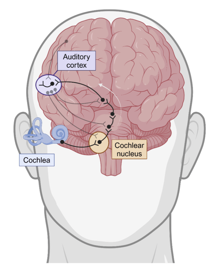 Do you hear what I hear? That ringing sound? – PennNeuroKnow