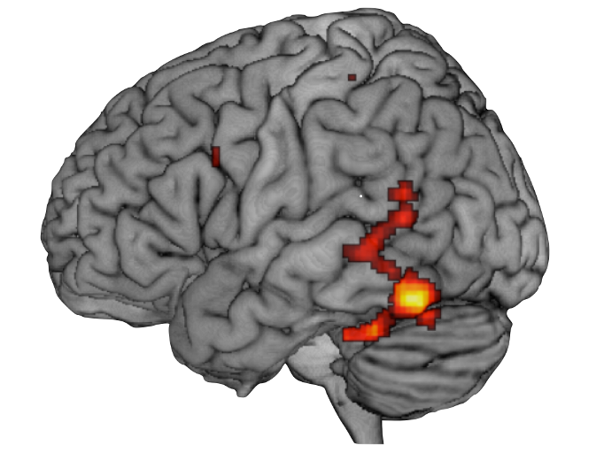 Two sides of the matter: The human brain may be symmetric in form, but ...
